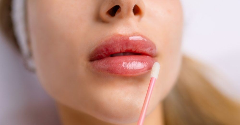 Lip Filler Migration: Solutions and Expert Tips | SpaMedica